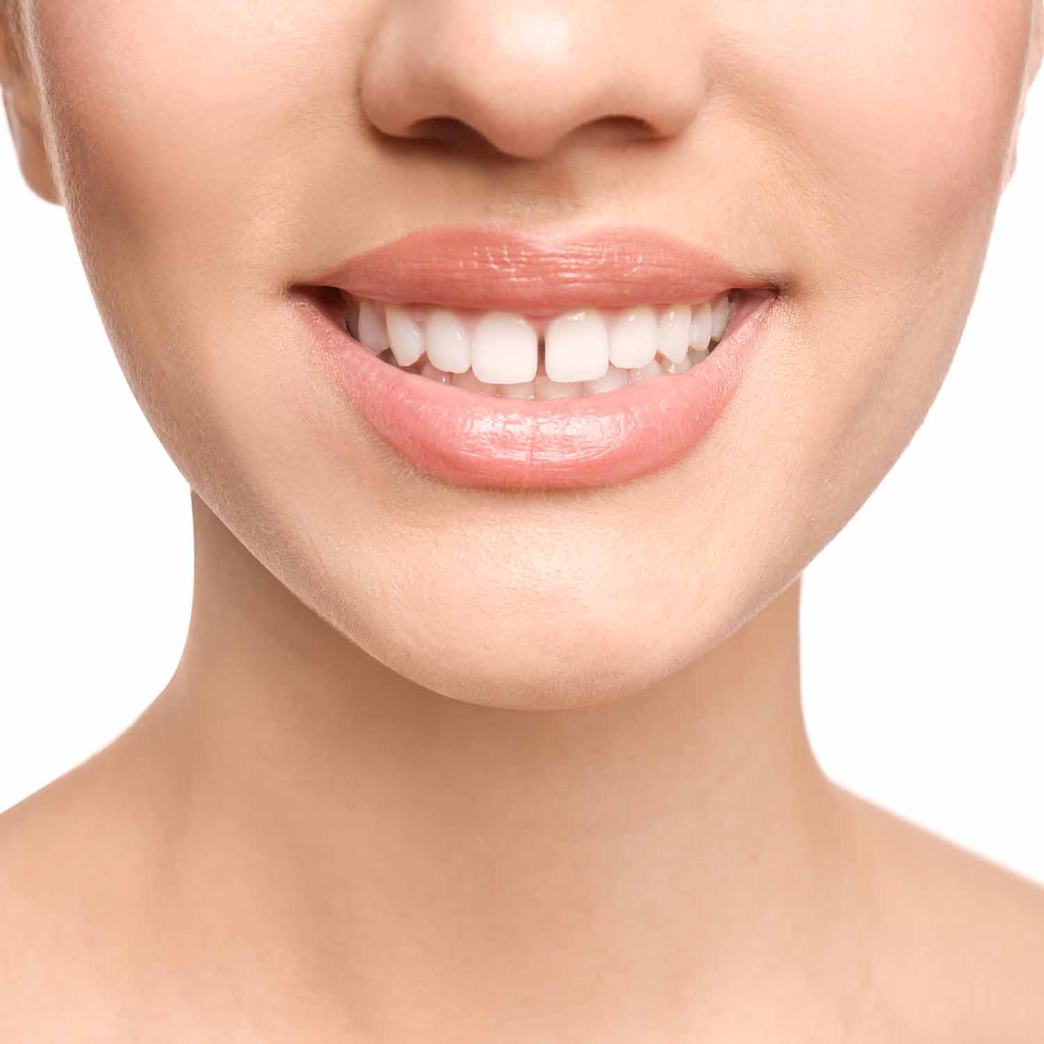 How to Fill Gaps Between Teeth: Your Guide to Diastema